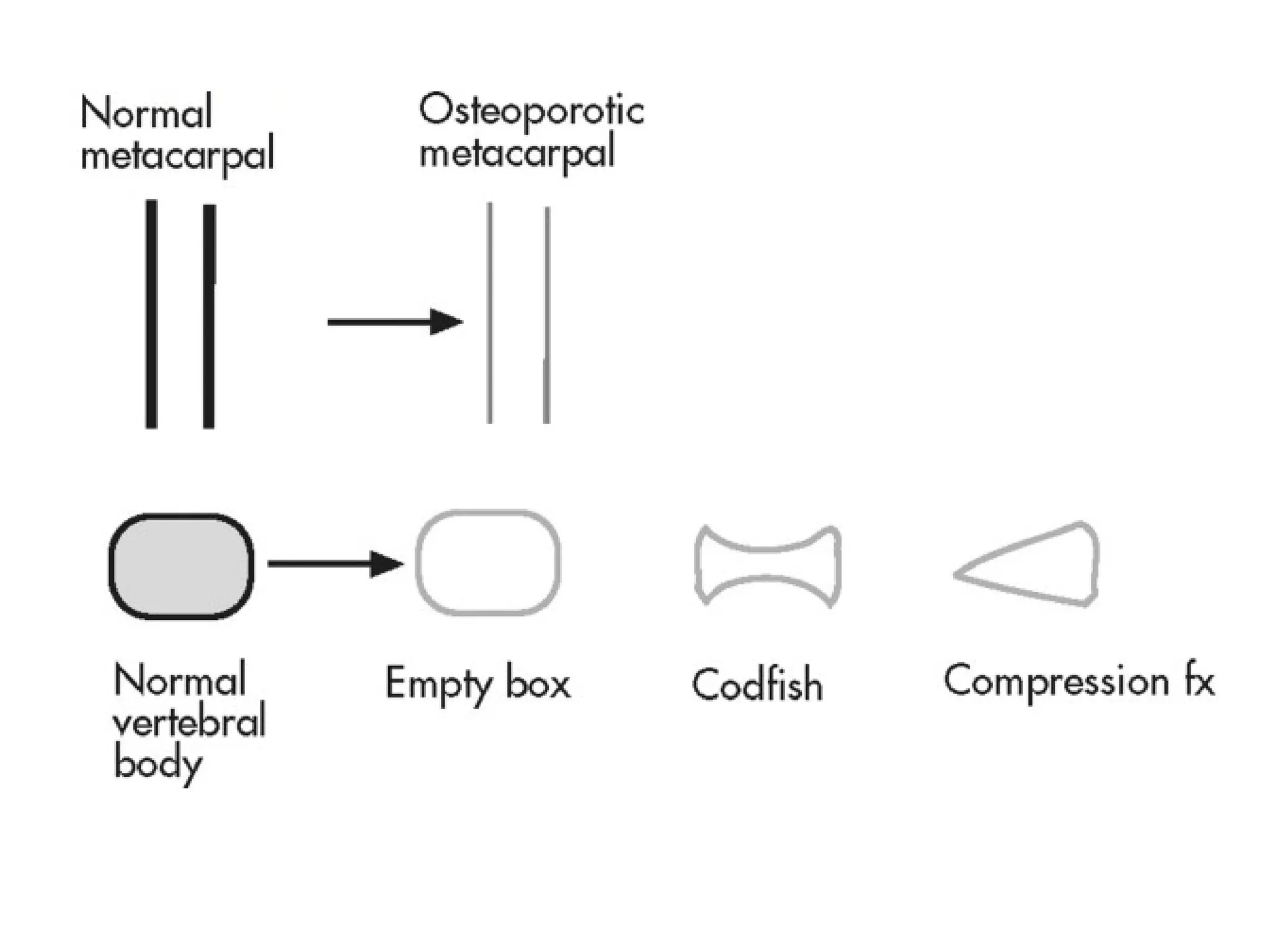 Diagnostic Imaging of Osteopenia | PPT