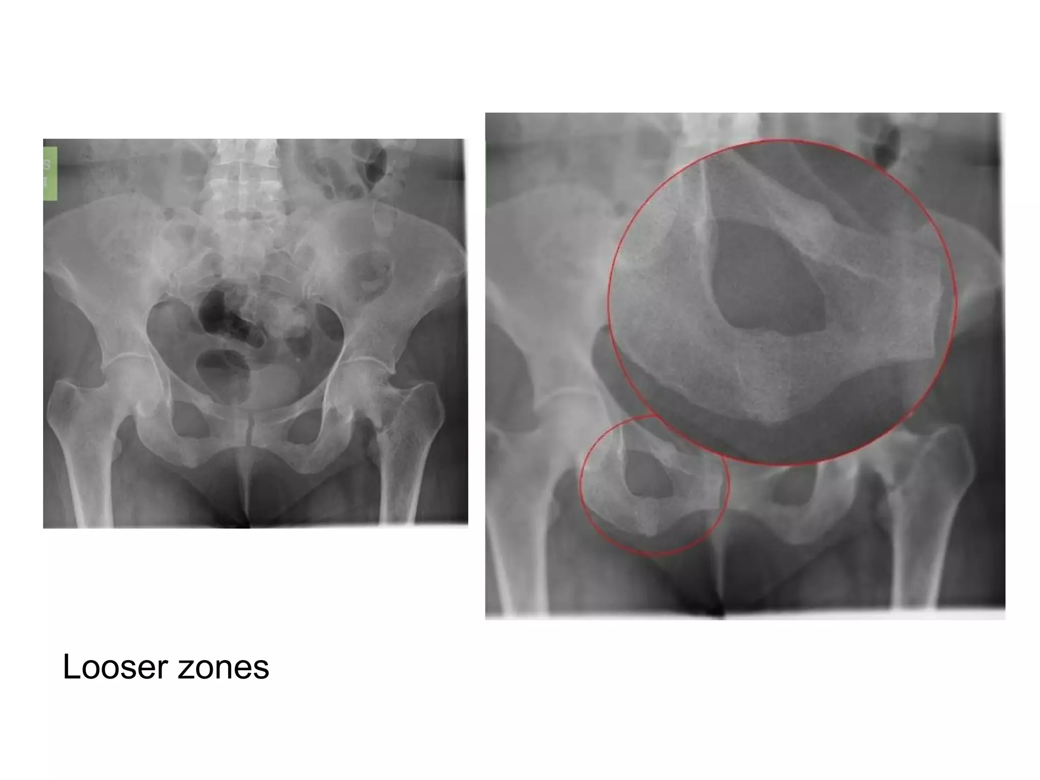 Diagnostic Imaging of Osteopenia | PPT