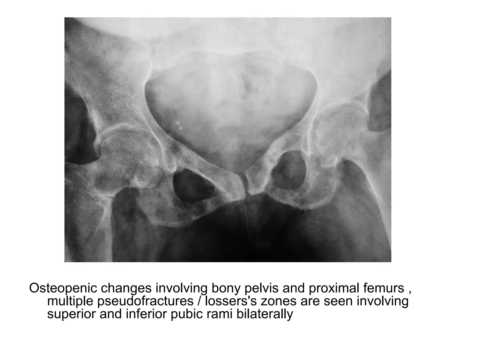 Diagnostic Imaging of Osteopenia | PPT