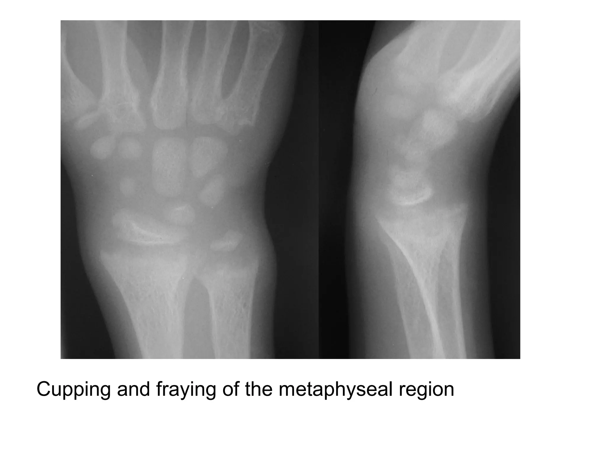 Diagnostic Imaging of Osteopenia | PPT