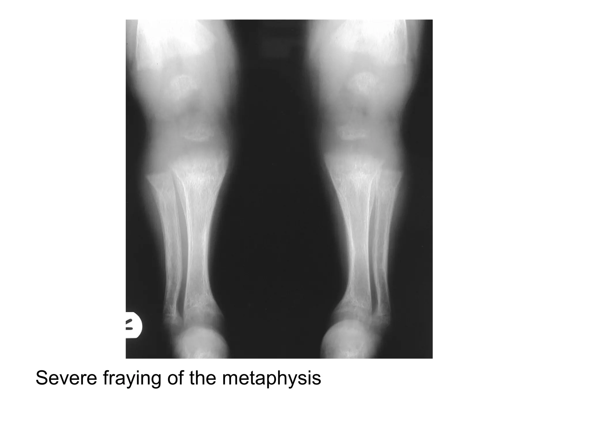 Diagnostic Imaging of Osteopenia | PPT