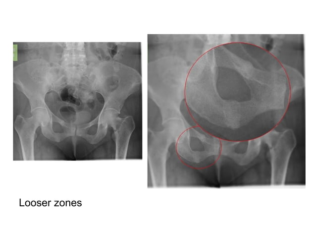 Diagnostic Imaging of Osteopenia | PPT