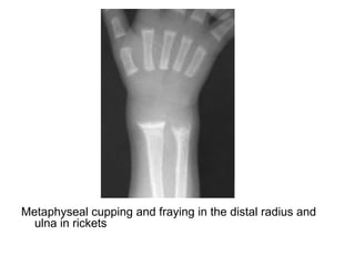 Diagnostic Imaging of Osteopenia | PPT