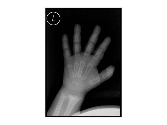 Diagnostic Imaging of Osteopenia | PPT