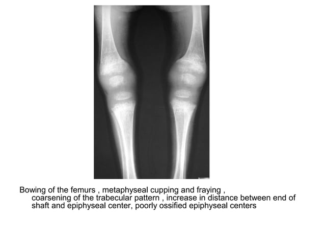 Diagnostic Imaging of Osteopenia | PPT