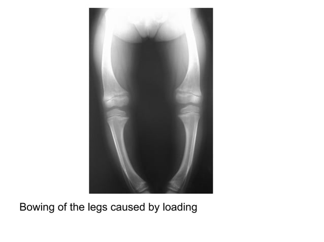 Diagnostic Imaging of Osteopenia | PPT