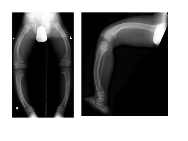 Diagnostic Imaging of Osteopenia | PPT