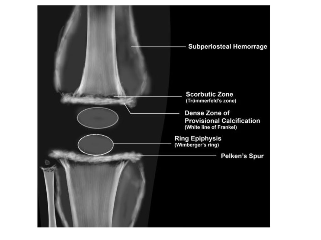 Diagnostic Imaging of Osteopenia