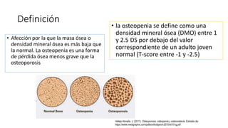 osteopenia.pptx