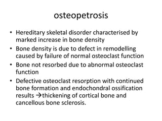 Osteopetrosis Histology