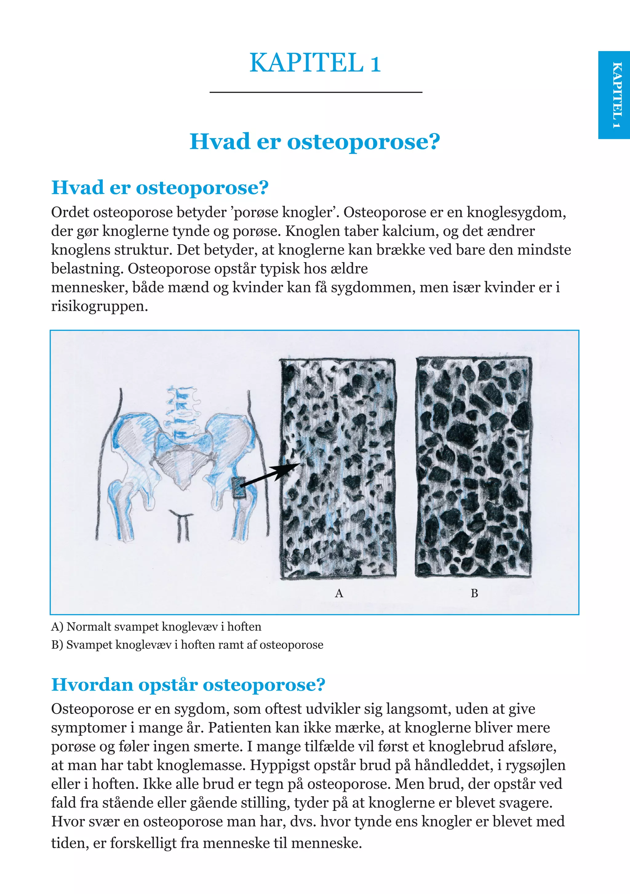 Osteoporose 2006 - Danmark