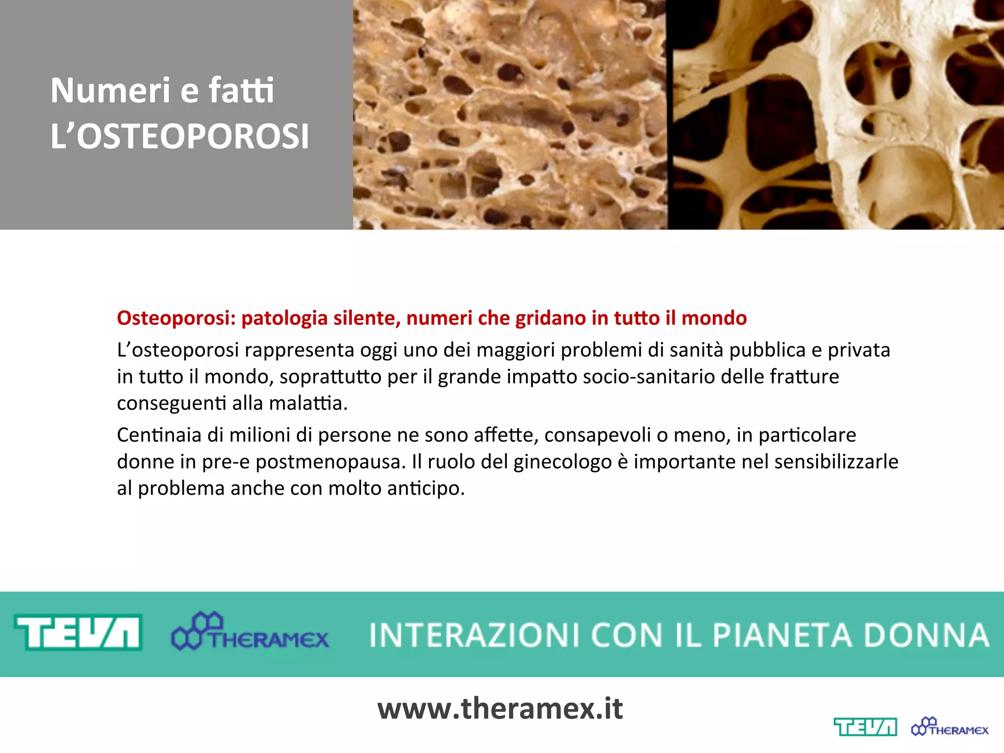 Speciale OSTEOPOROSI | PDF