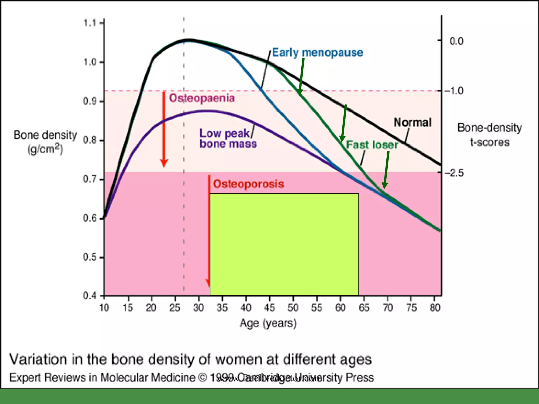 Osteoporosis | PPT
