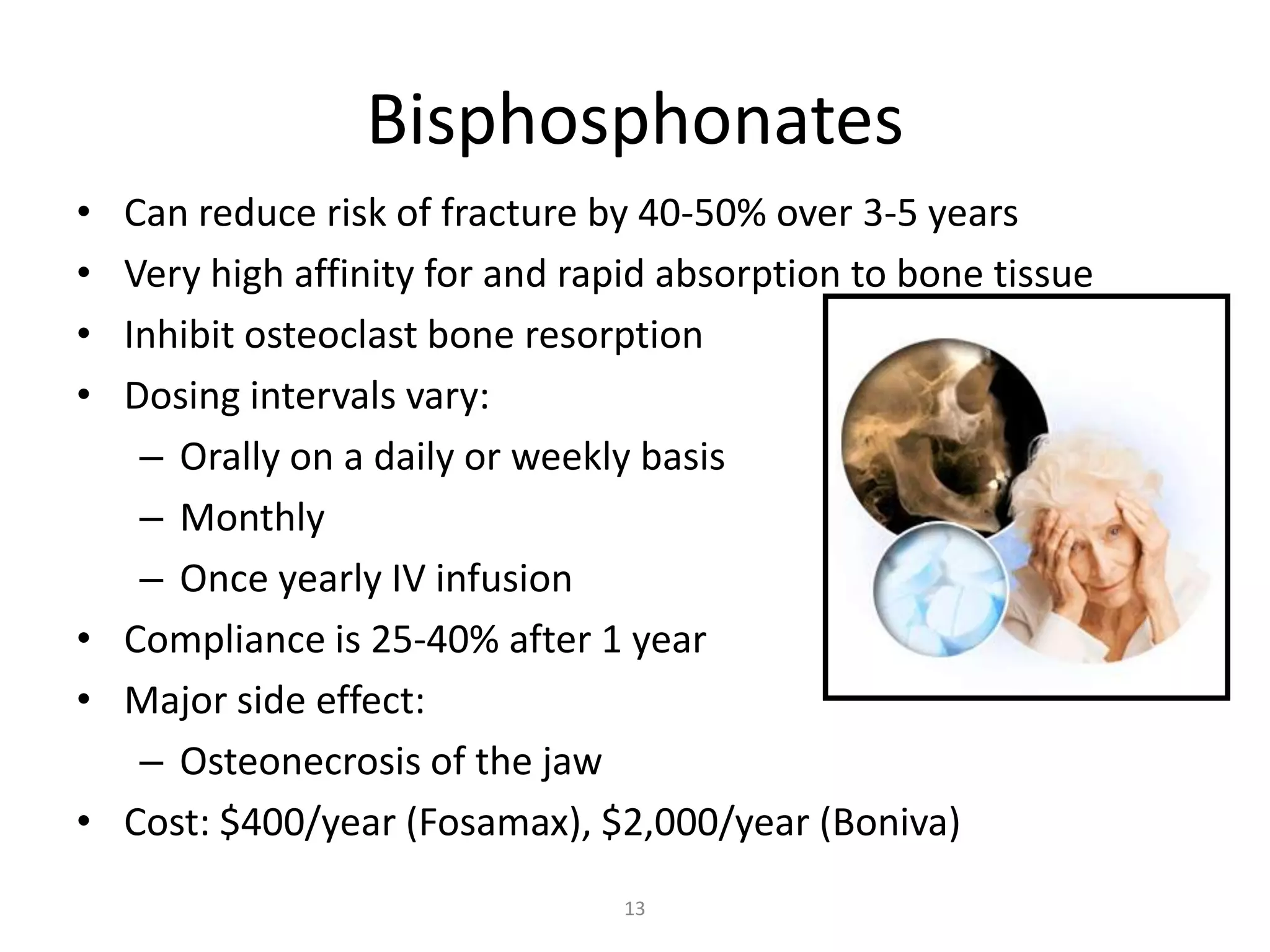 Osteoporosis Therapy Overview | PPTX