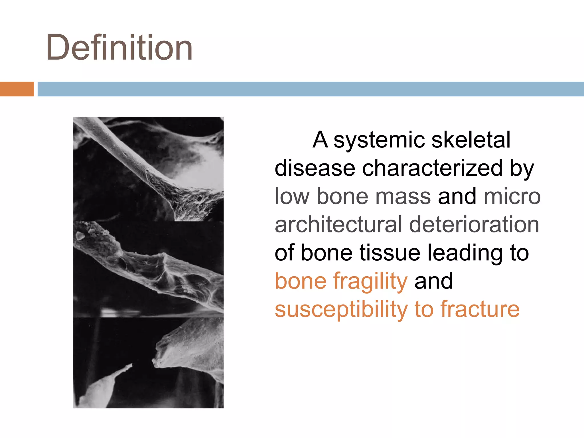 Osteoporosis | PPTX