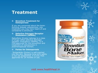 Osteoporosis | PPTX | Menopause | Endocrine and Metabolic Diseases