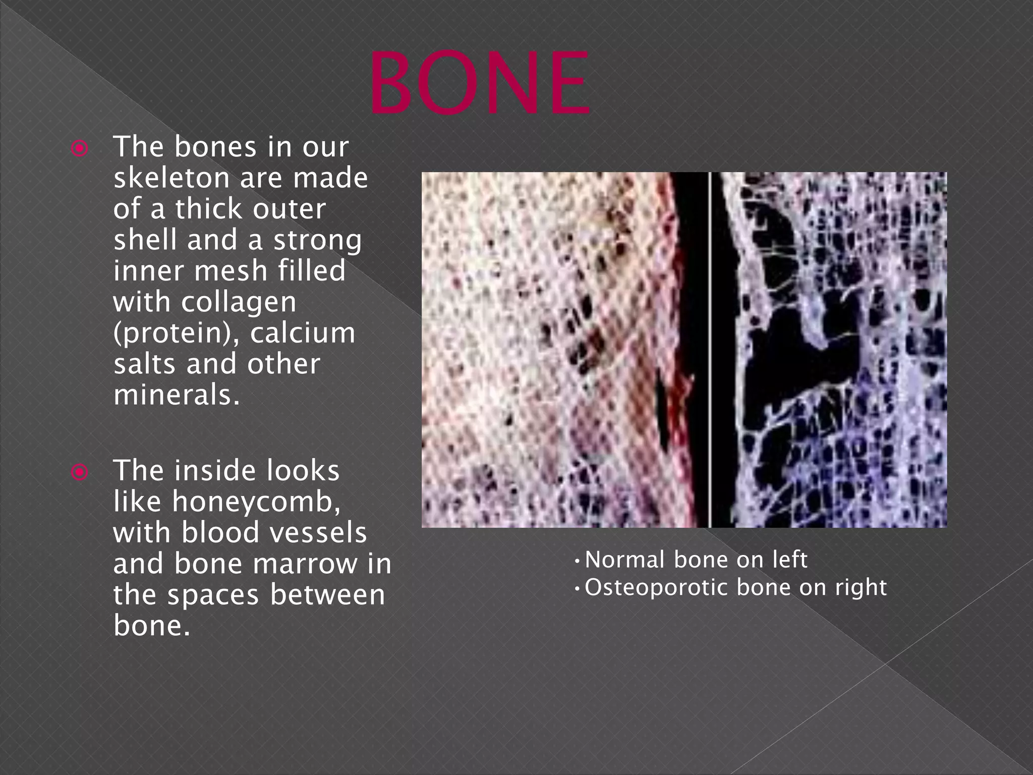 Osteoporosis | PPTX | Bone and Joint Conditions | Diseases and Conditions