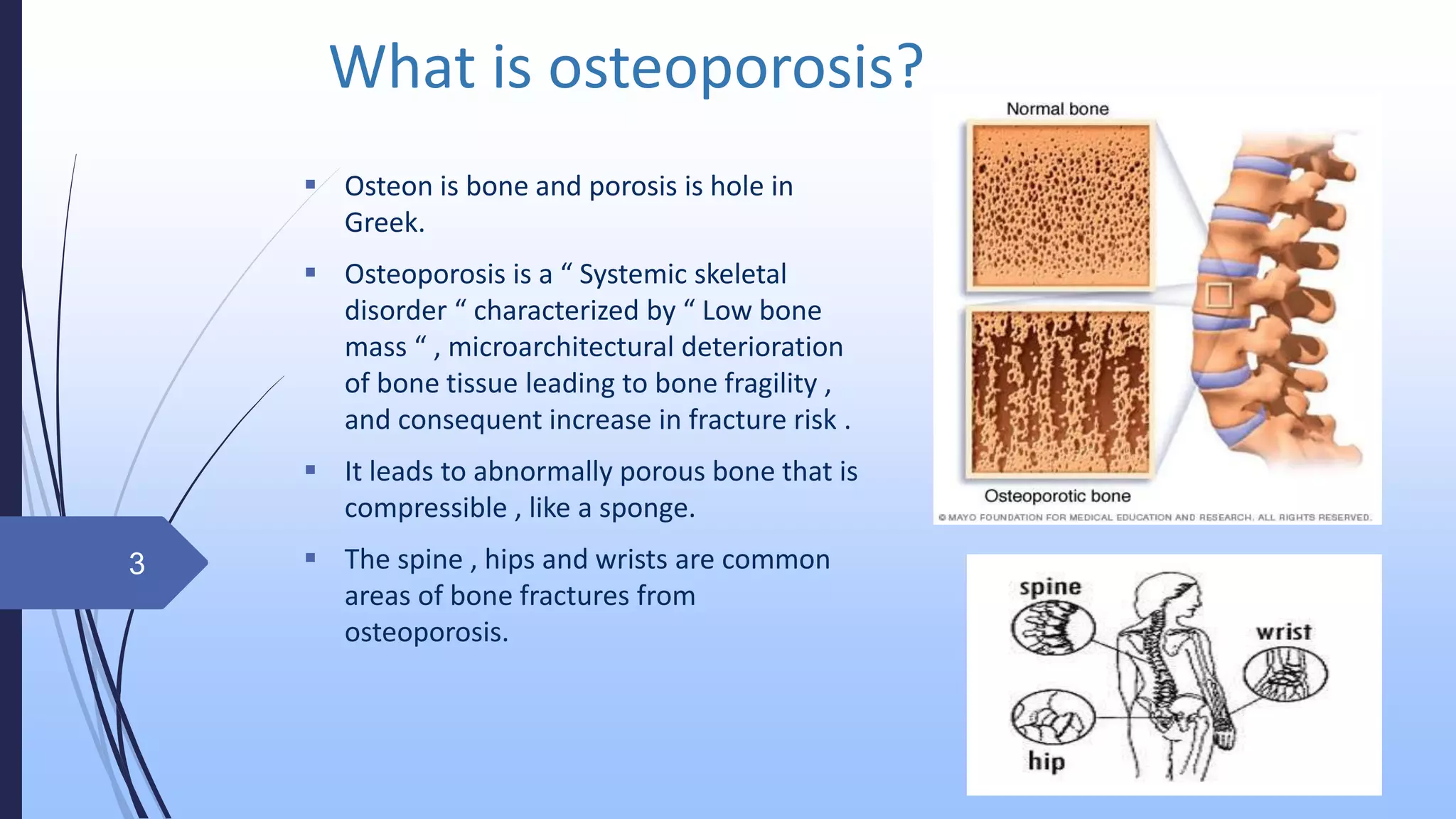 Osteoporosis | PPTX