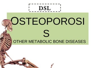 Osteoporosis | PPT