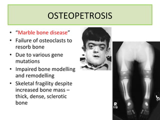 Osteoporosis | PPT