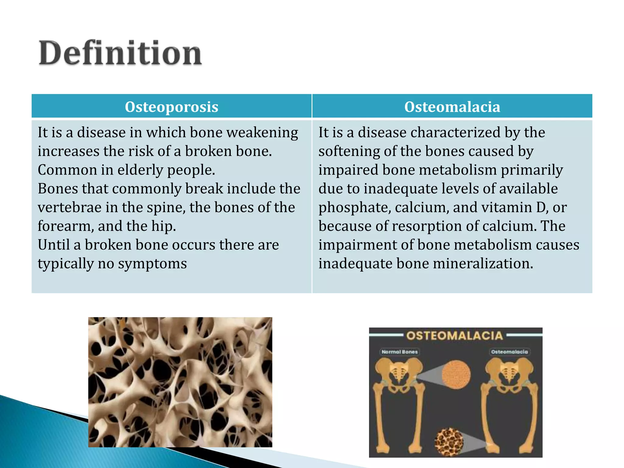 Osteoporosis and Osteomalacia | PPTX