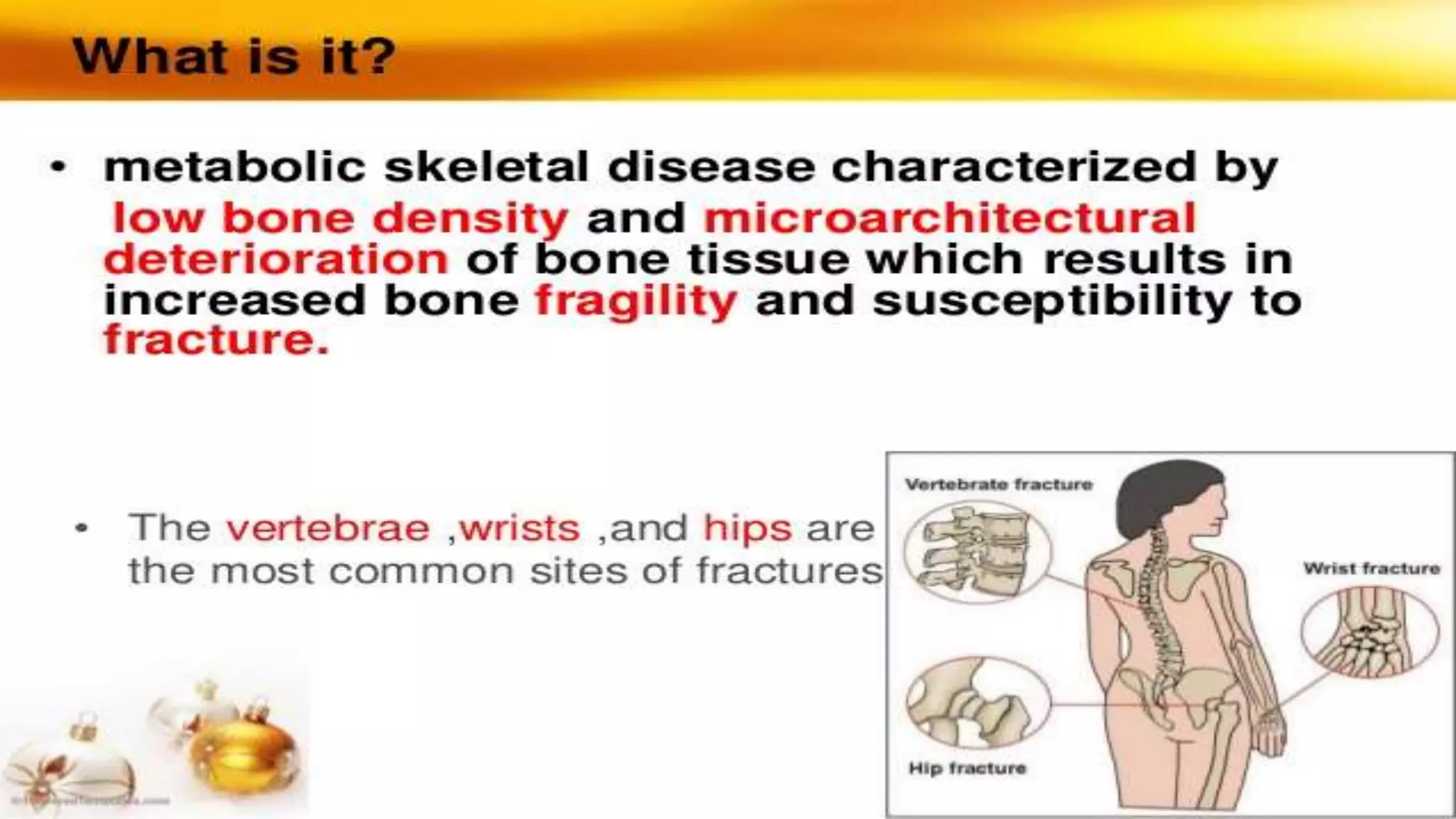 Osteoporosis Musculo Skeletal Disorders For Nursing Student Under ...