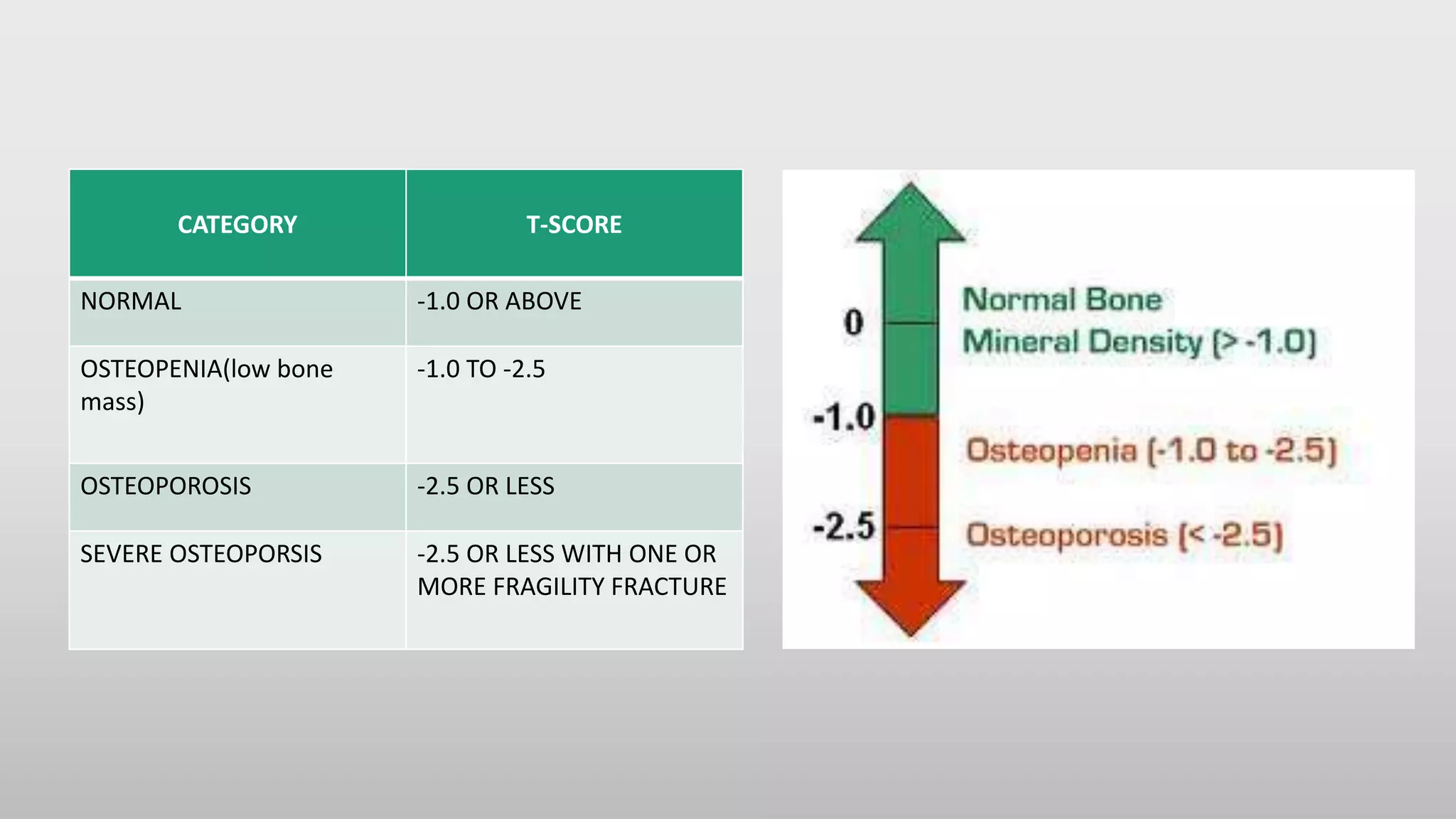 OSTEOPOROSIS.pptx