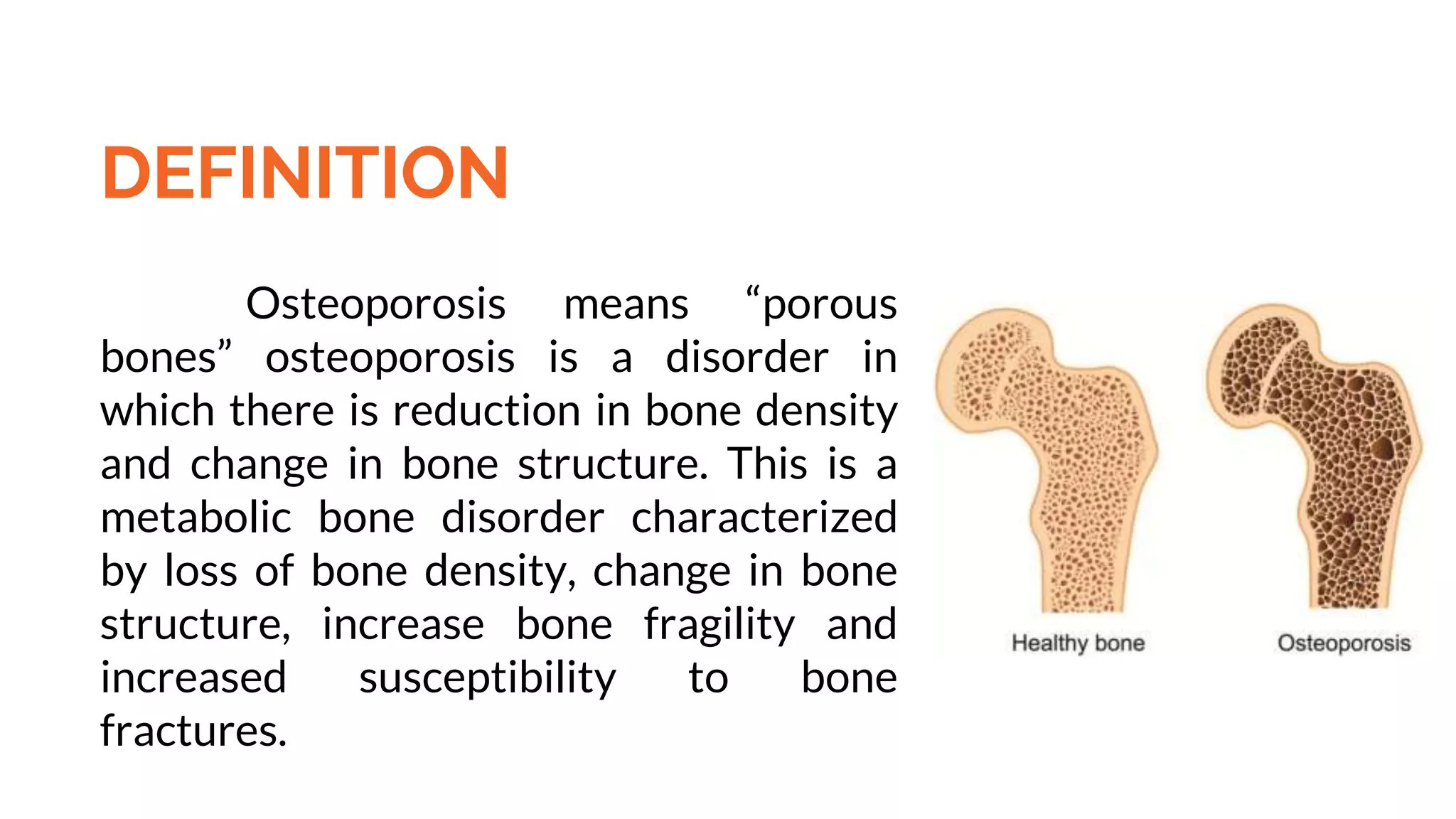 Osteoporosis.pptx