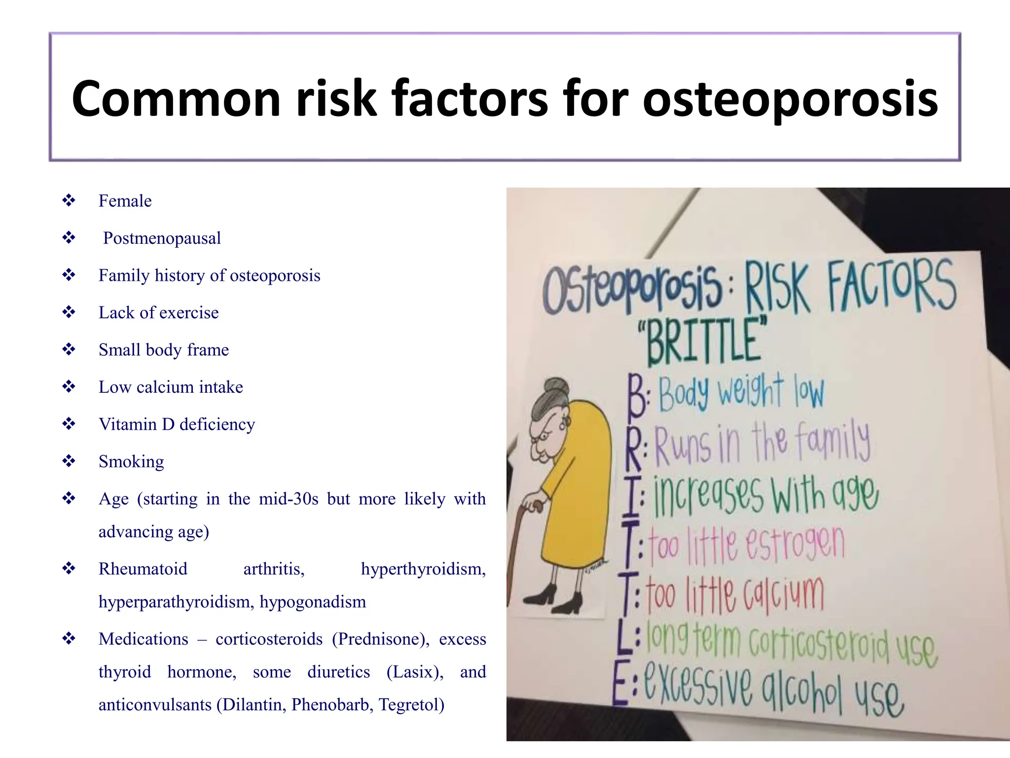Osteoporosis in elderly causes and management | PPTX