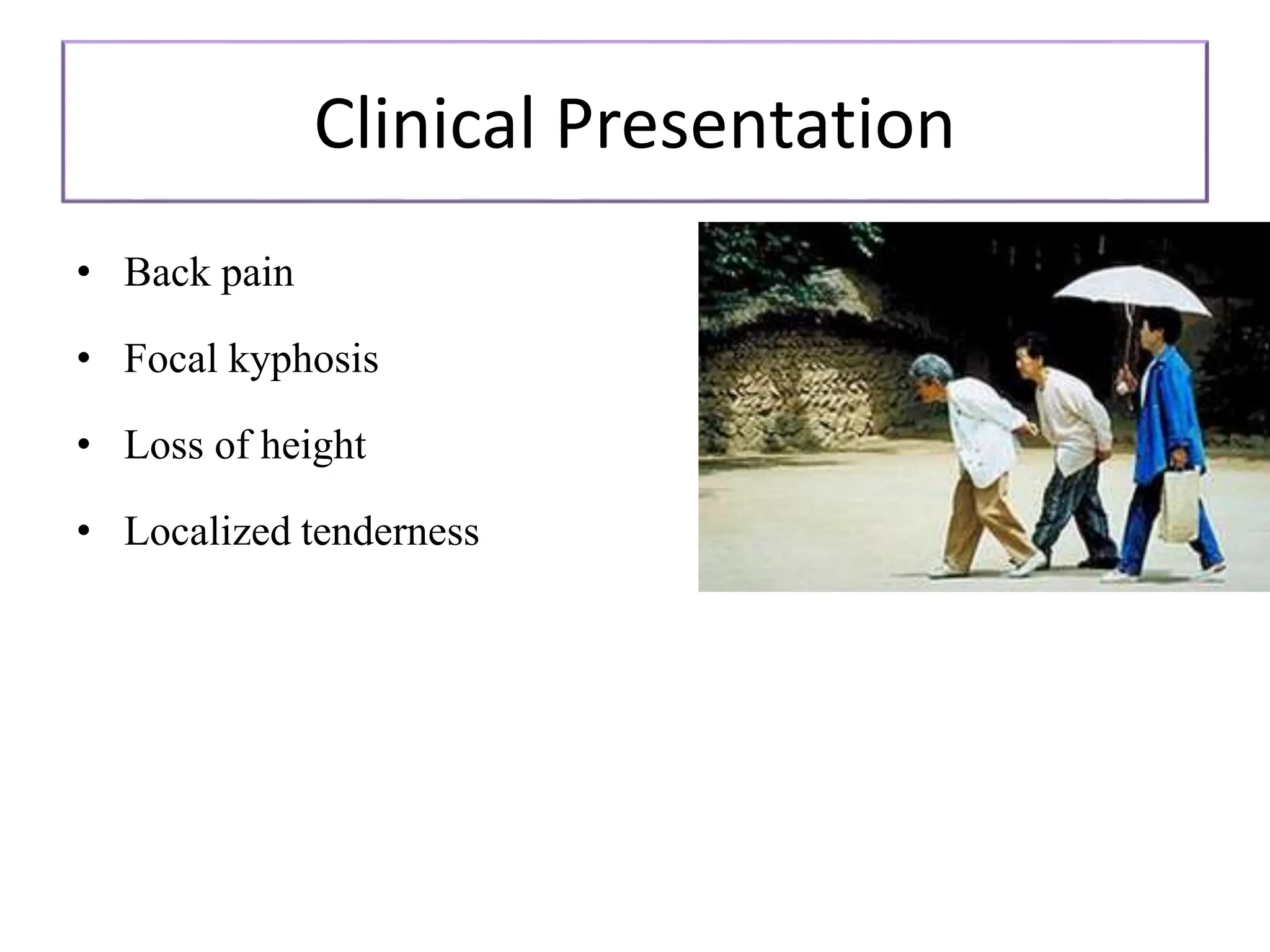 Osteoporosis in elderly causes and management | PPTX