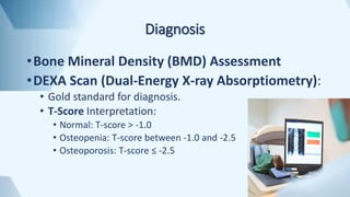 Osteoporosis: Understanding, Prevention, and Management (an official presentation) | PDF