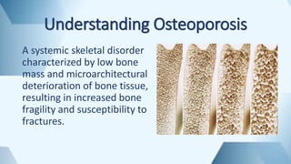 Osteoporosis: Understanding, Prevention, and Management (an official ...