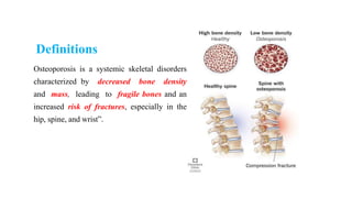 Osteoporosis: lead to a decrease in bone strength that can increase the ...
