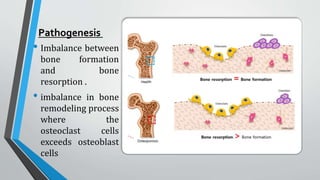 Osteoporosis clinical picture risk factors and treatment | PPTX