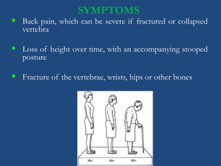Osteoporosis, diagnosis and management | PPTX | Bone and Joint ...