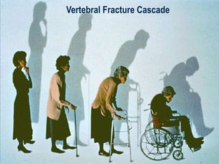 Osteoporosis, diagnosis and management | PPTX | Bone and Joint ...