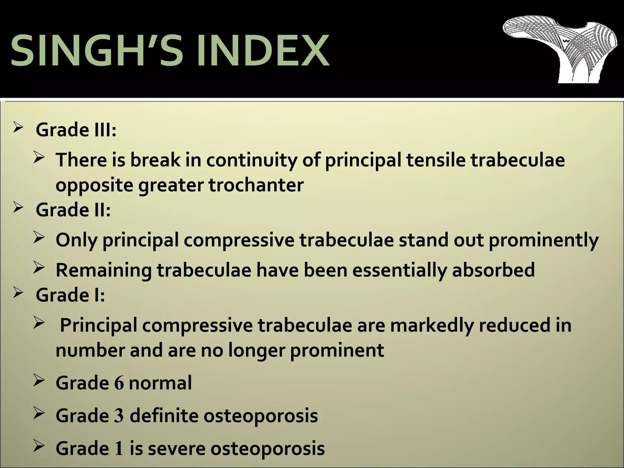 Osteoporosis dr akbar | PPT