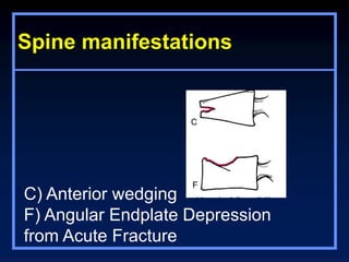 Osteoporosis editted | PPT