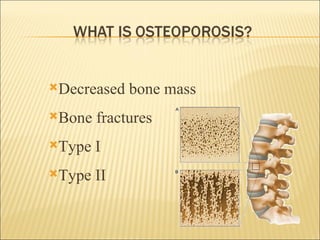 Osteoporosis guideline | PPT