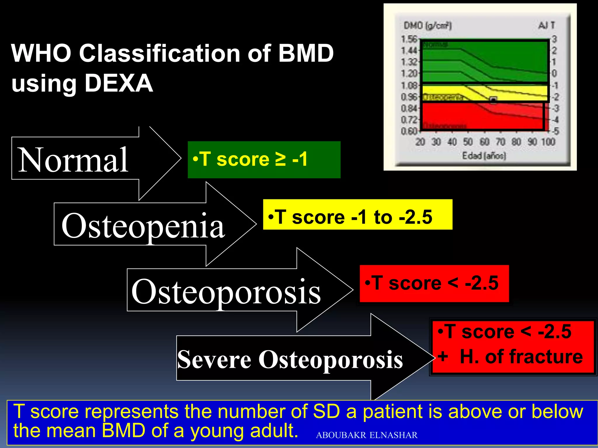 The role of the gynecologist in screening & prevention of Osteoporosis ...