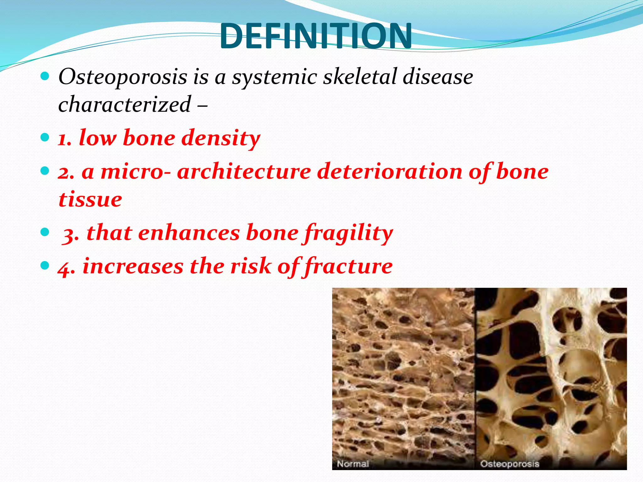 Osteoporosis my ppt | PPTX