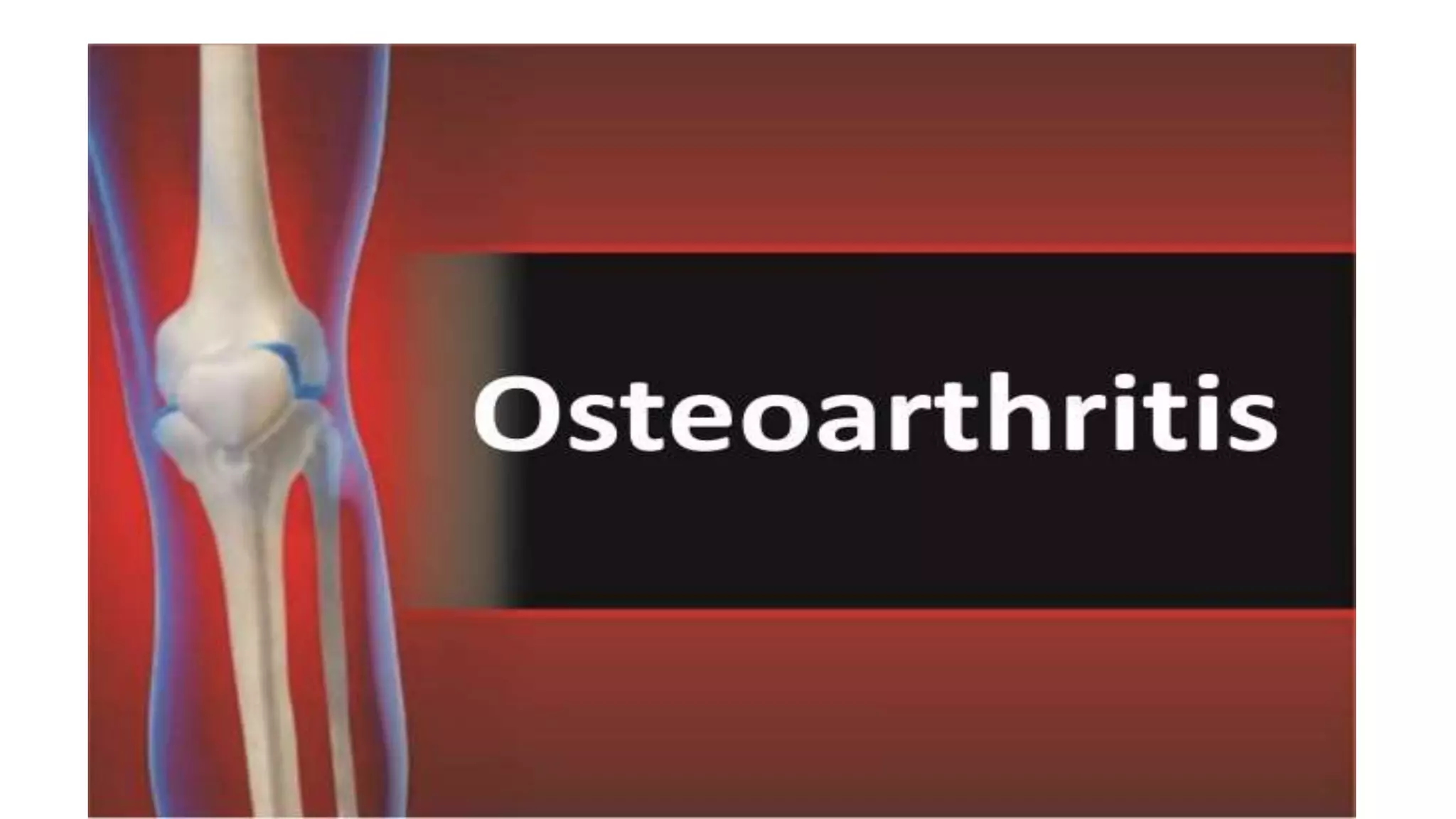 Osteoporosis & osteoarthritis | PPTX