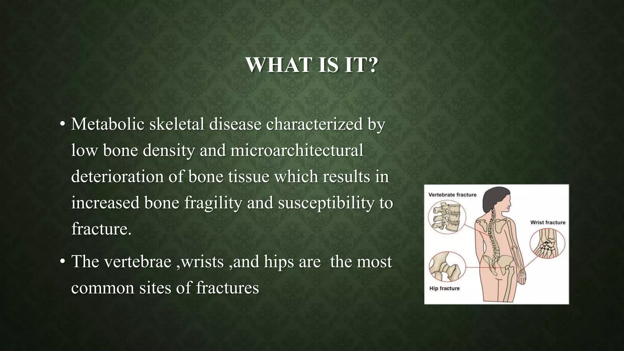 Osteoporosis | PDF