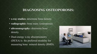 Osteoporosis | PDF