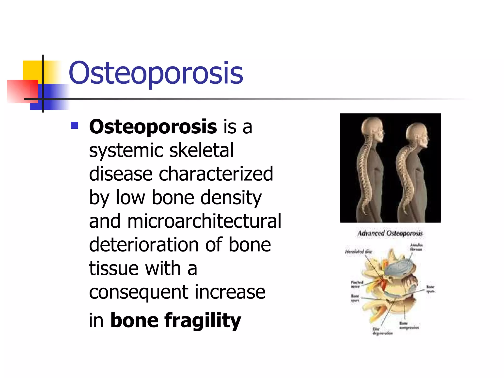 Osteoporosis Prevention And Management | PPT