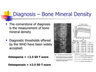 Osteoporosis Prevention And Management | PPT