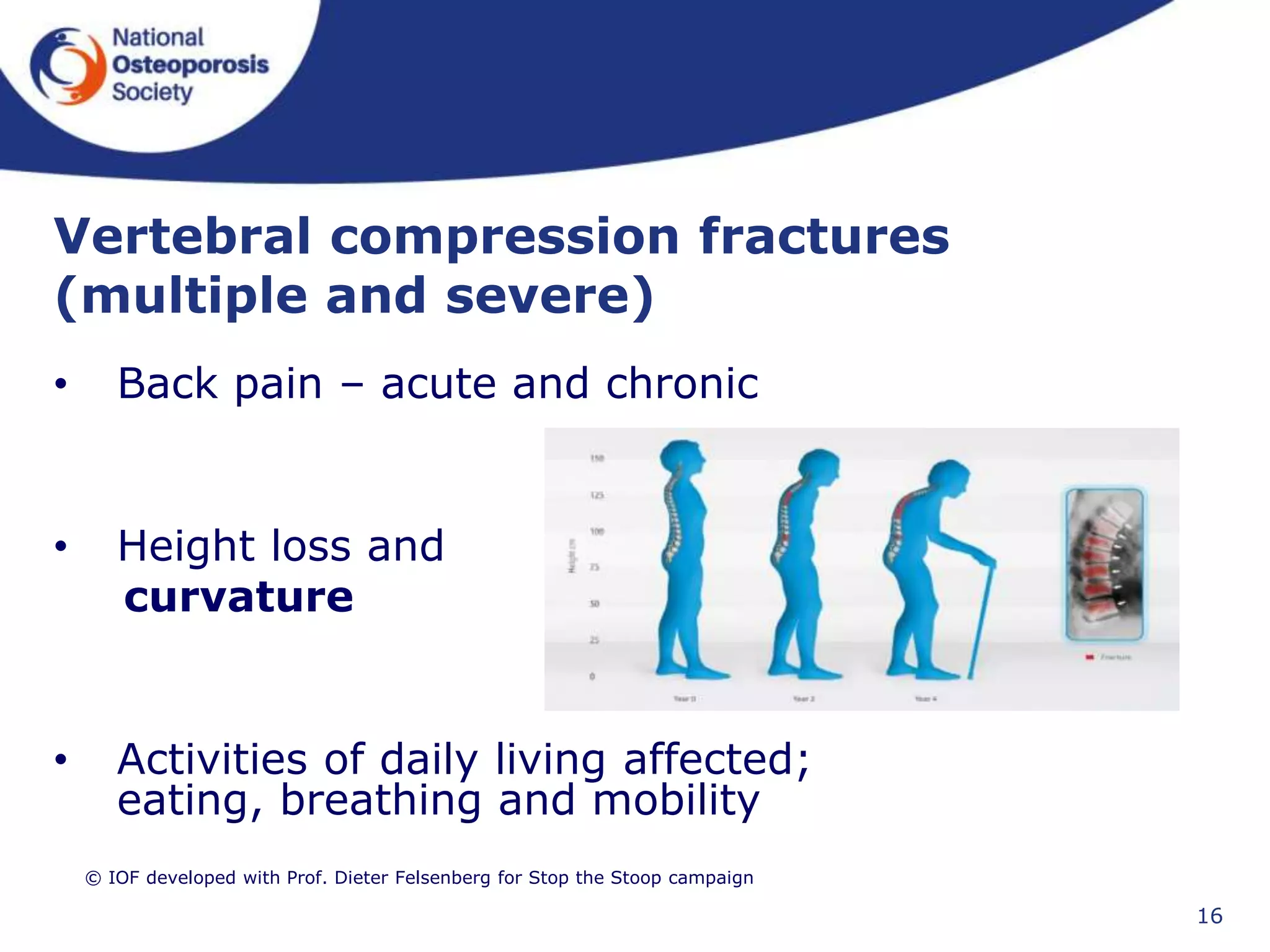 Osteoporotic back pain | PPT
