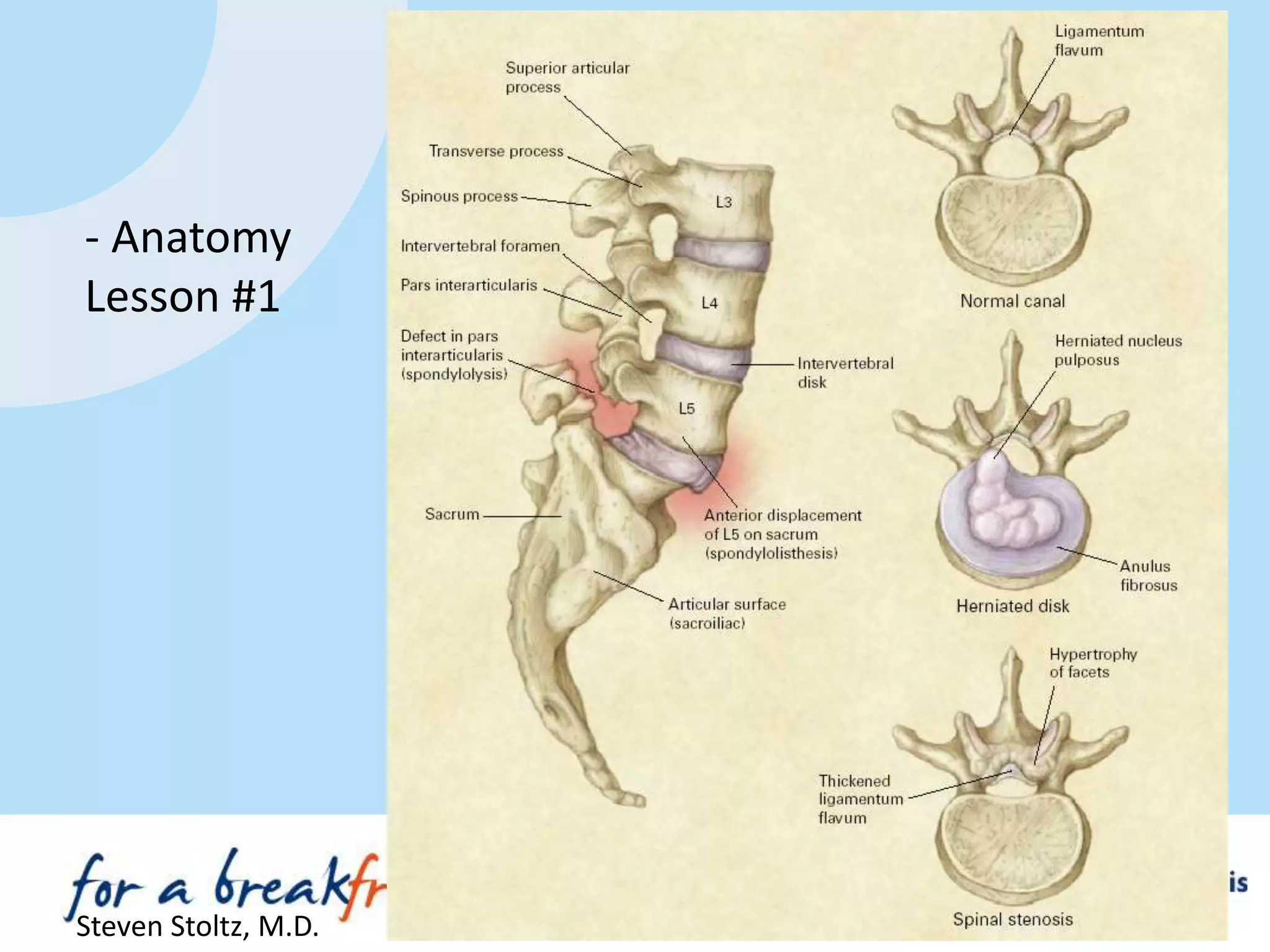 Osteoporotic back pain | PPT