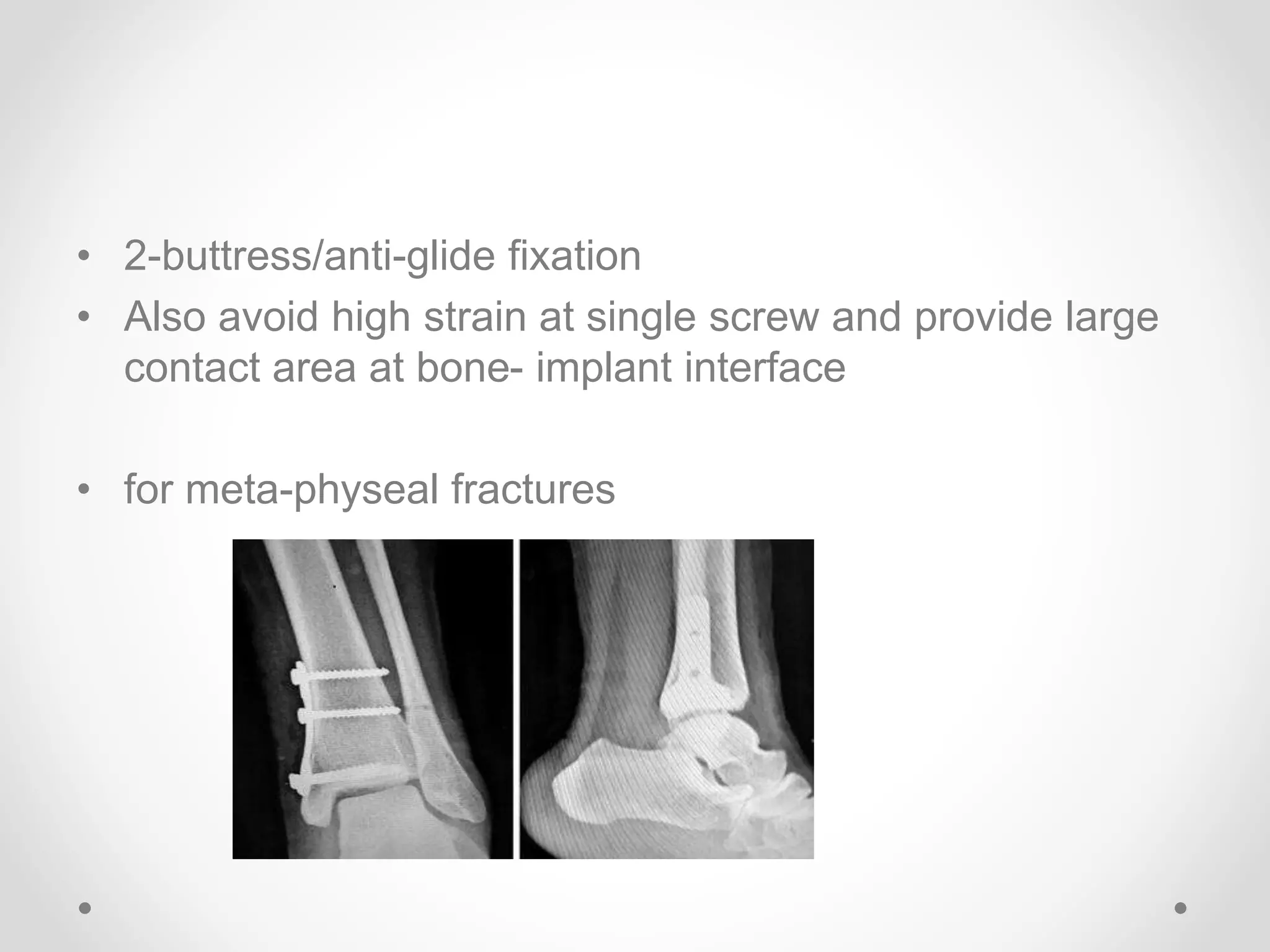 osteoporotic bone fractures .pptx