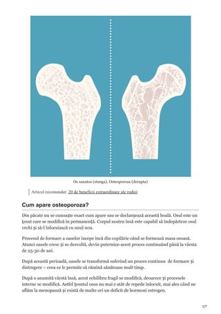 Osteoporoza - Cauze, simptome, tratament | Alternamed.ro